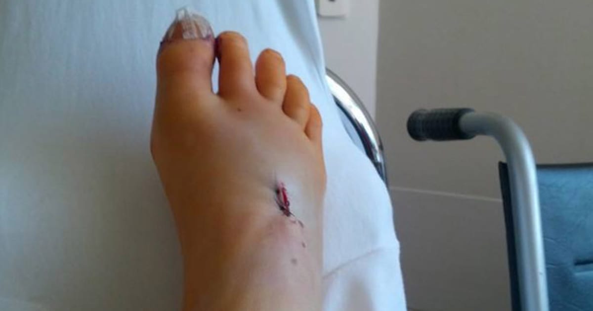 Katrin Meyer: Sturz, Fussbruch, Operation und Tränen - IDM Seitenwagen ...